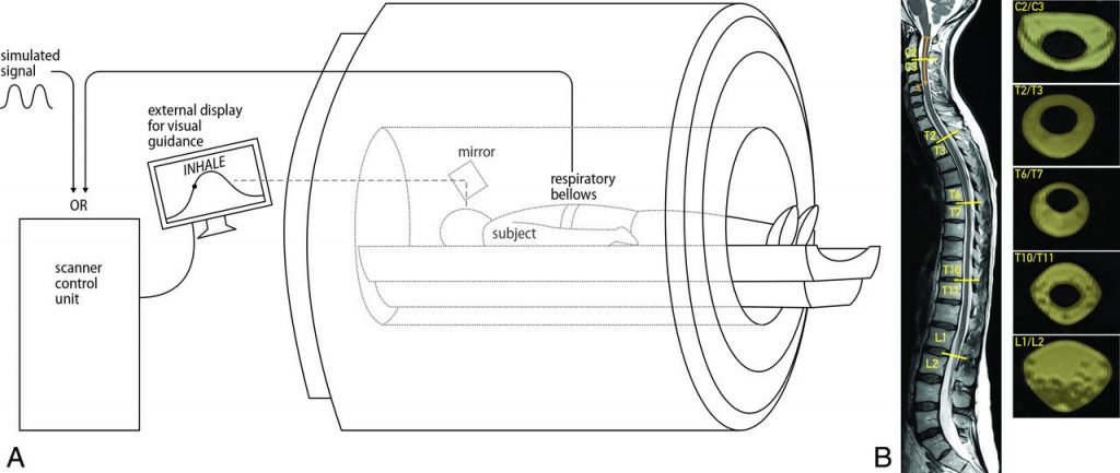 Cerebrospinal Flow Dynamics - Multiscale Flow Physics