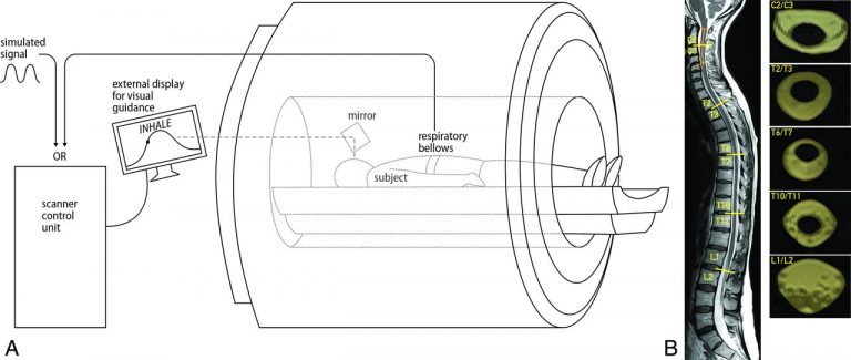 Cerebrospinal Flow Dynamics - Multiscale Flow Physics